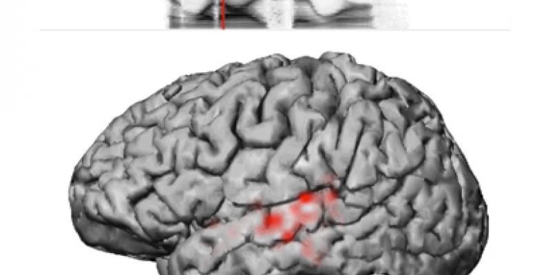 New Study Reveals How the Brain Recognizes Speech Sounds | Columbia News New Study Reveals How the Brain Recognizes Speech Sounds | Columbia News