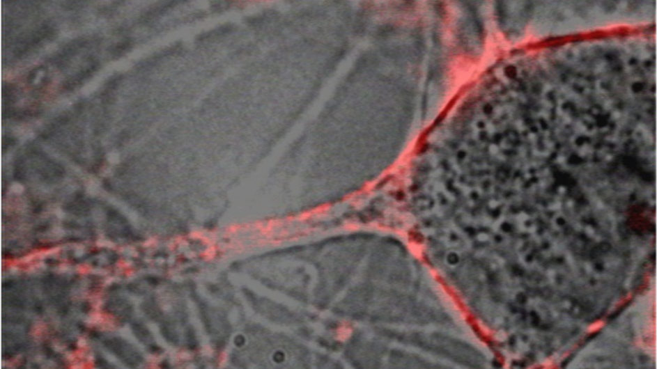 Monitoring Living Brain Cells with Ultra Small Particles | Columbia News