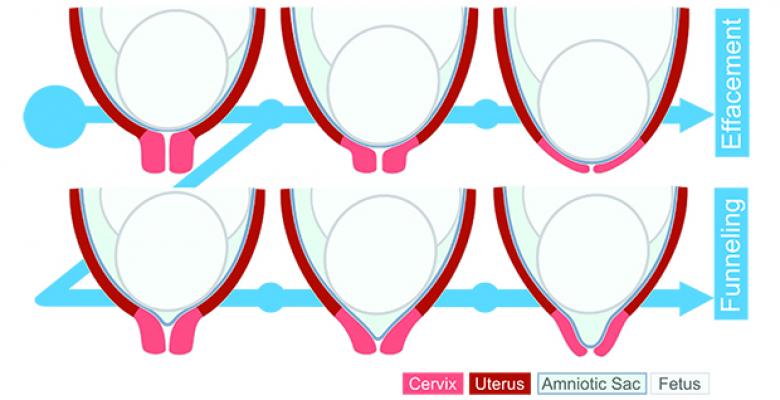 Prof. Kristin Myers Studies the Mechanics of Pregnancy | Columbia News